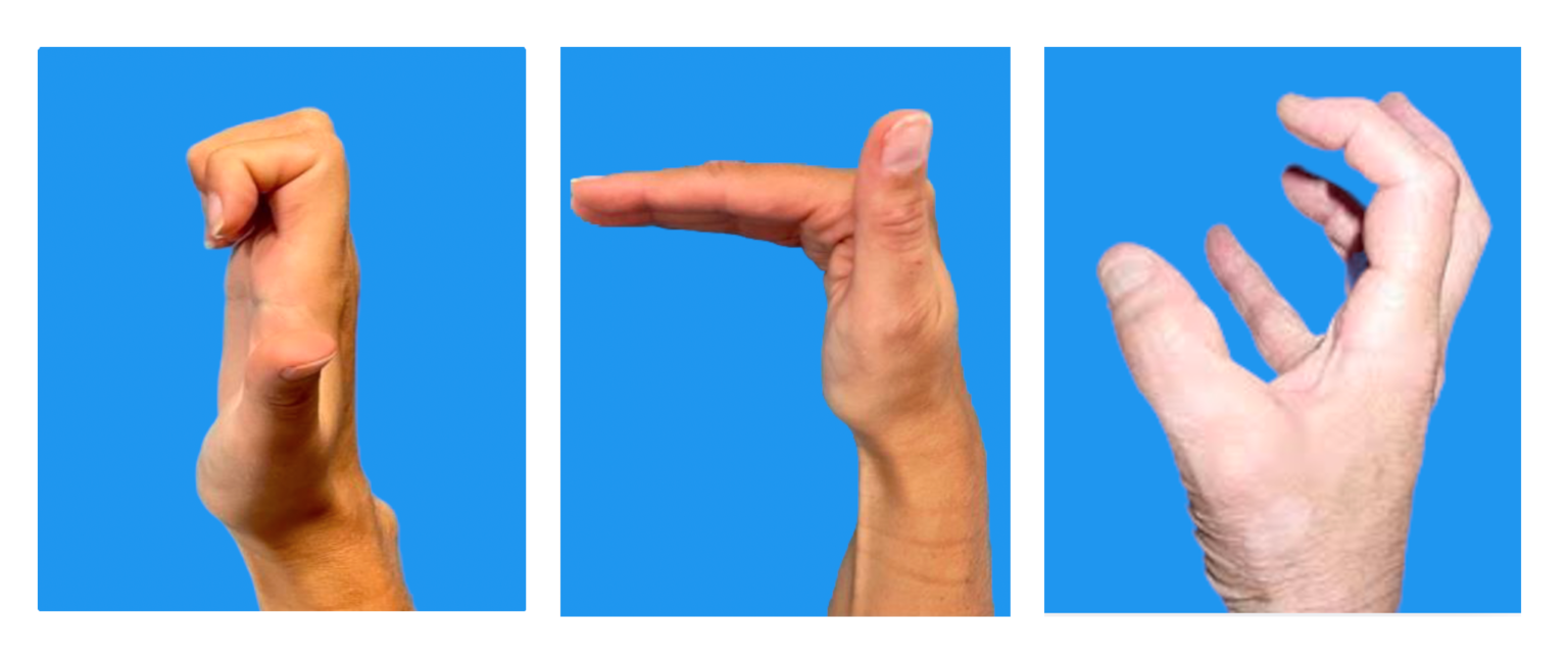 Hand Exercises After Surgery - Azouz Hand SurgeryAzouz Hand Surgery
