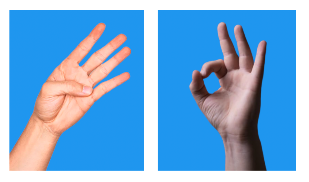 Hand Exercises After Surgery - Azouz Hand SurgeryAzouz Hand Surgery